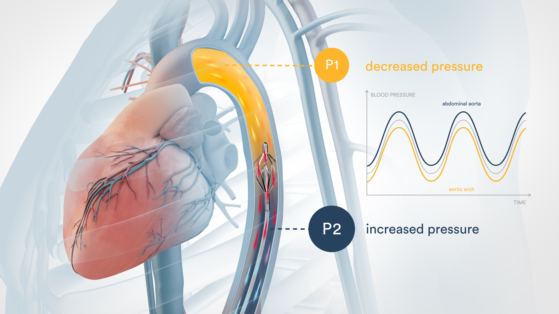 Presentation of study results | Cardiobridge
